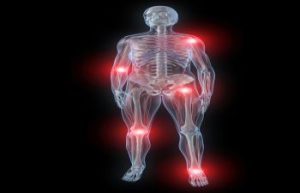 Nerve Compression Syndrome Causes and Treatment | New York, NY